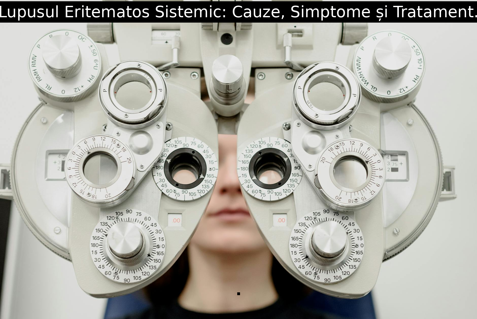 Lupusul Eritematos Sistemic: Cauze, Simptome și Tratament. - Ghid Sanatate